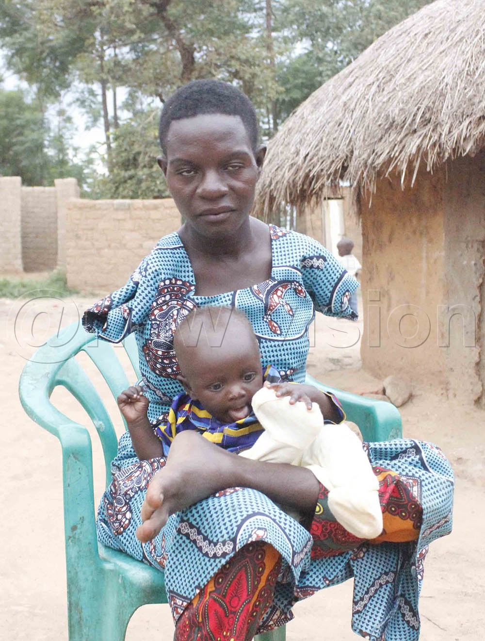 IN THE WEEK PAST: Husband abandons armless mother - New Vision Official